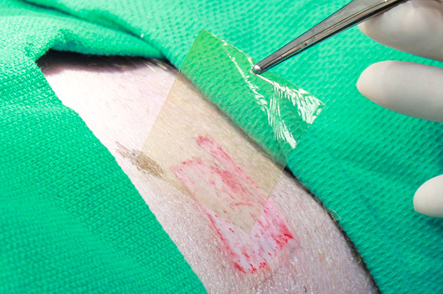 New antimicrobial for textiles